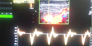 radiology | Genu Path Labs